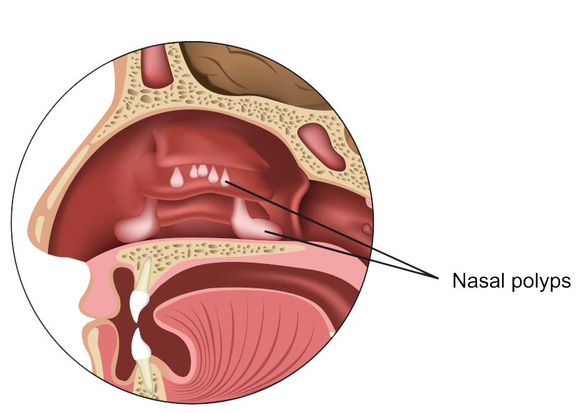 Respiration buccale – KD1 Cabinet de Pédodontie & d'Orthodontie